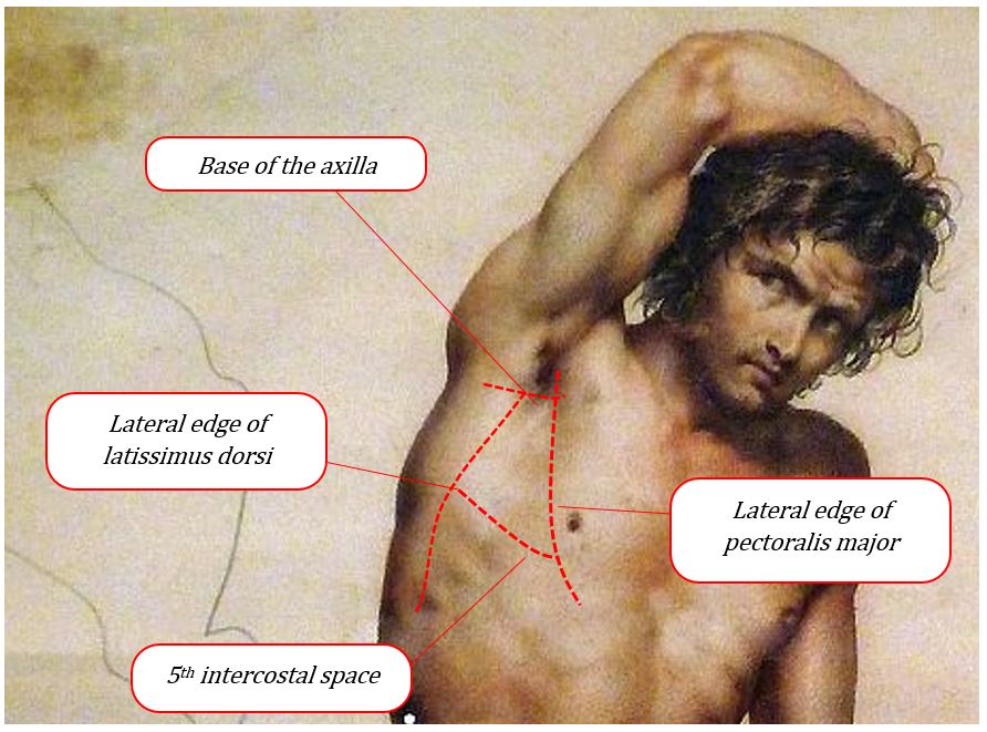 Safety Triangle For Chest Tube Tube Thoracostomy Dr Ellahi Bakhsh Routine Use Of Ultrasound